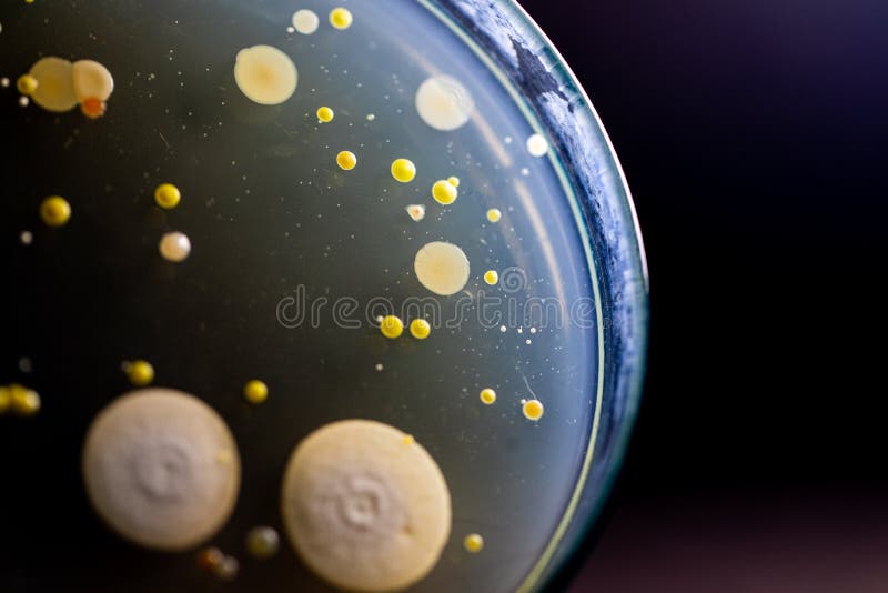 Backgrounds of Characteristics and Different Shaped Colony of Bacteria ...