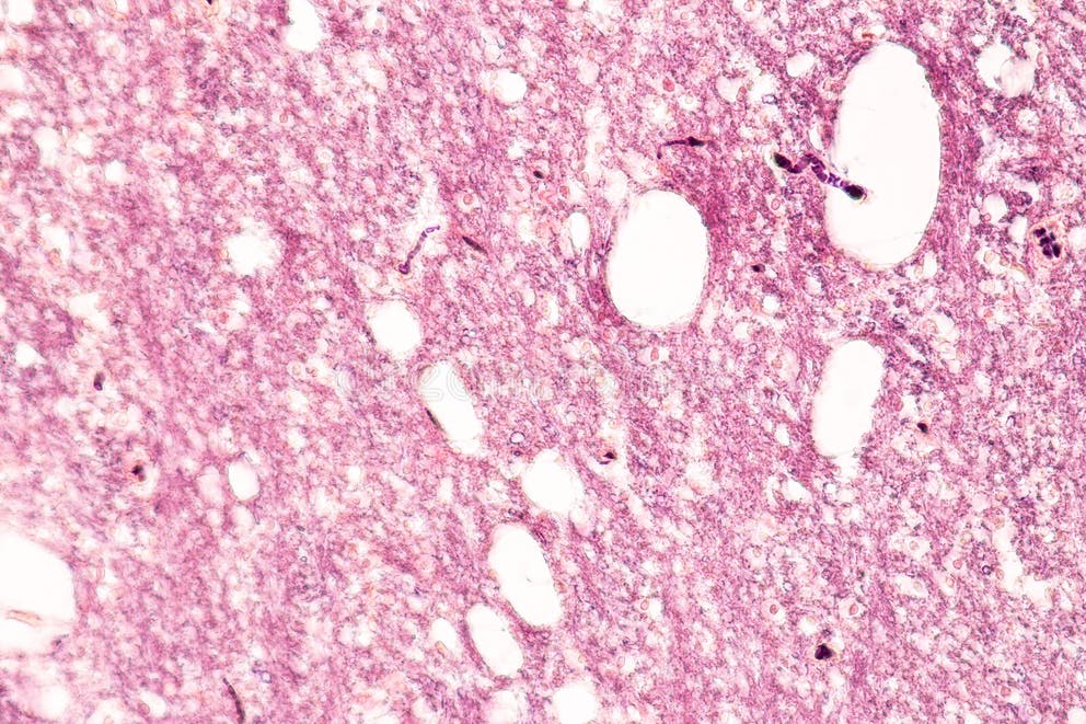 Human Nervous System Under the Microscope in Lab. Stock Photo - Image ...