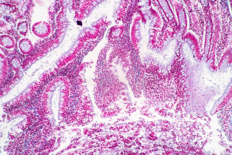204 Large Intestine Under Microscope Stock Photos - Free & Royalty-Free ...
