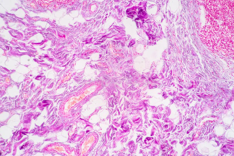 Tissue of Stomach Human, Small Intestine Human, Pancreas Human and ...