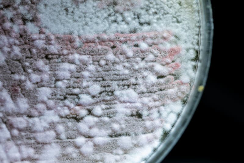 Colony Characteristics of Mold Under the Microscope. Stock Photo ...