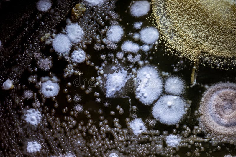Colony Characteristics of Mold Under the Microscope. Stock Image ...