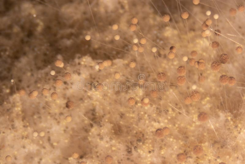 Colony Characteristics of Mold Under the Microscope. Stock Photo ...