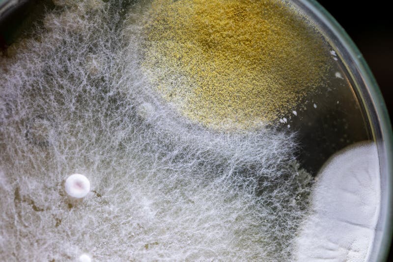 Colony Characteristics of Mold Under the Microscope. Stock Photo ...