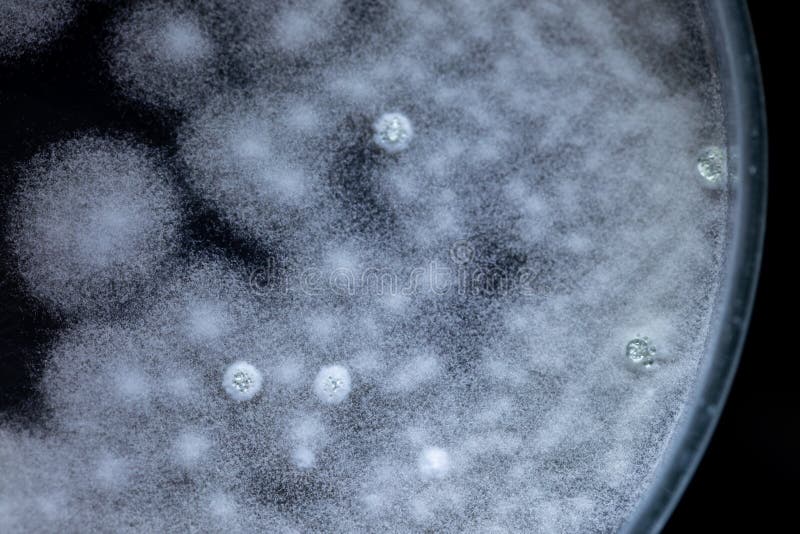 Colony Characteristics of Mold Under the Microscope. Stock Image ...