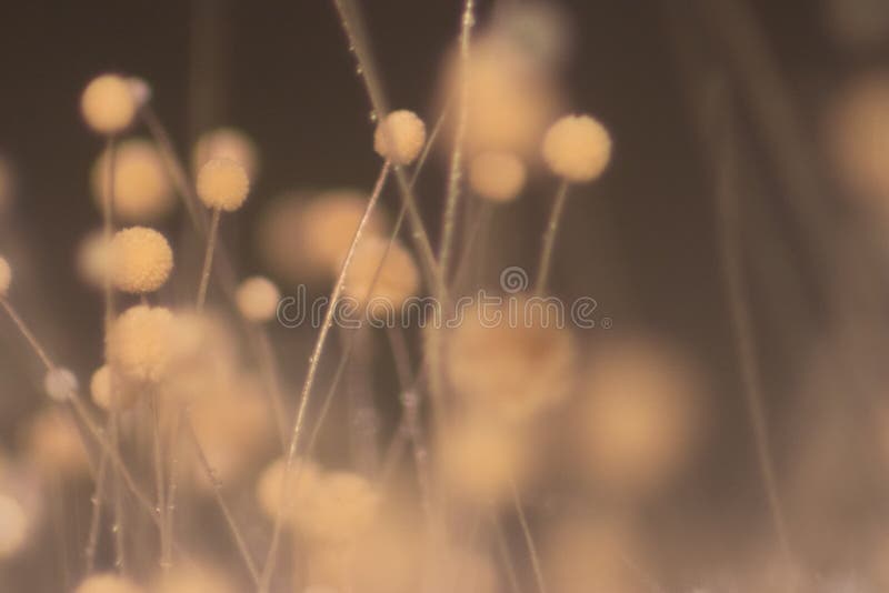 Colony Characteristics of Mold Under the Microscope. Stock Photo ...