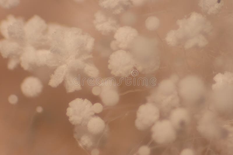 Colony Characteristics of Mold Under the Microscope. Stock Image ...