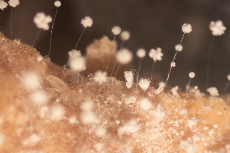 Colony Characteristics of Mold Under the Microscope. Stock Image ...