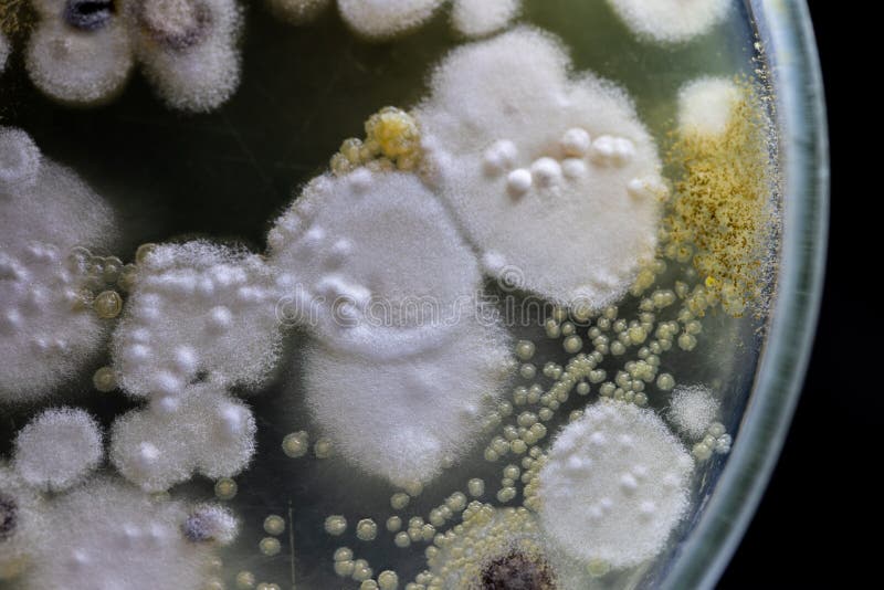 Colony Characteristics of Mold Under the Microscope. Stock Image ...