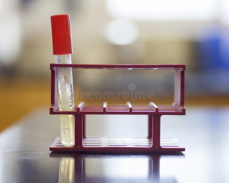 Bacterai Growing on an Agar Slant. Stock Photo - Image of experiment ...