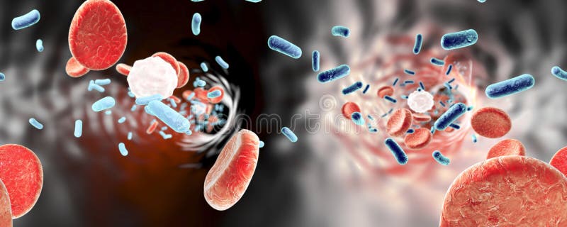 Bacteria in Blood, Bacteriemia Stock Illustration - Illustration of ...