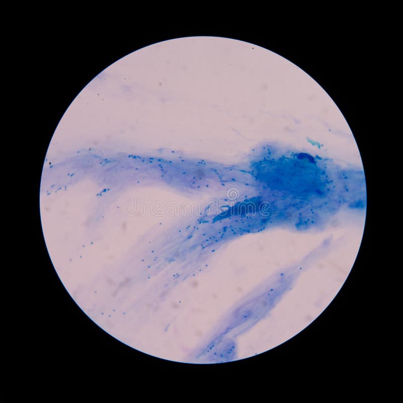 Gram Staining Stock Photos - Free & Royalty-Free Stock Photos from ...