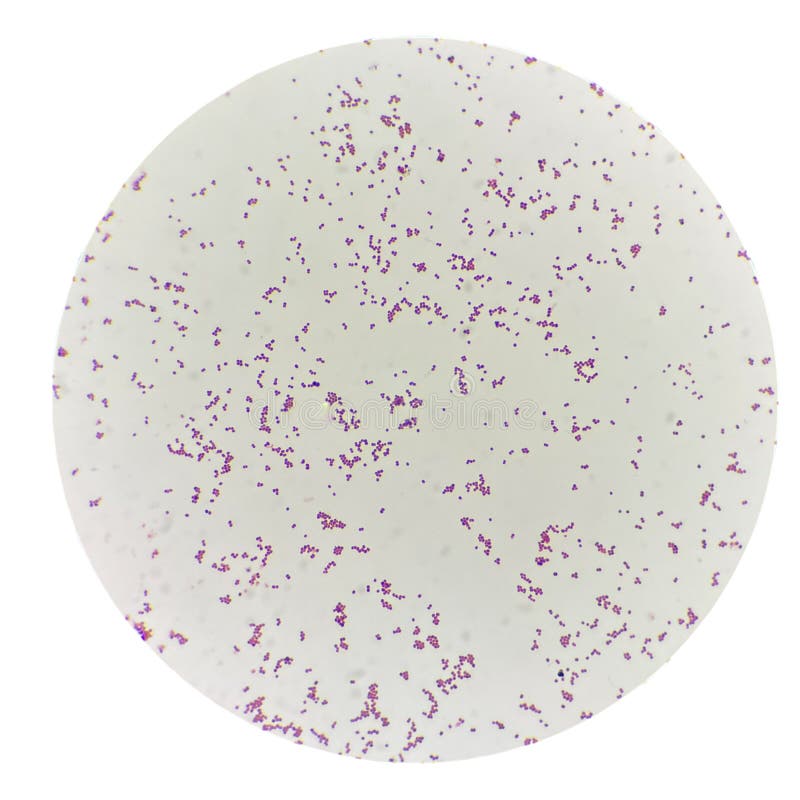 Bacteria Cell Finding with Microscope Stock Photo - Image of health ...