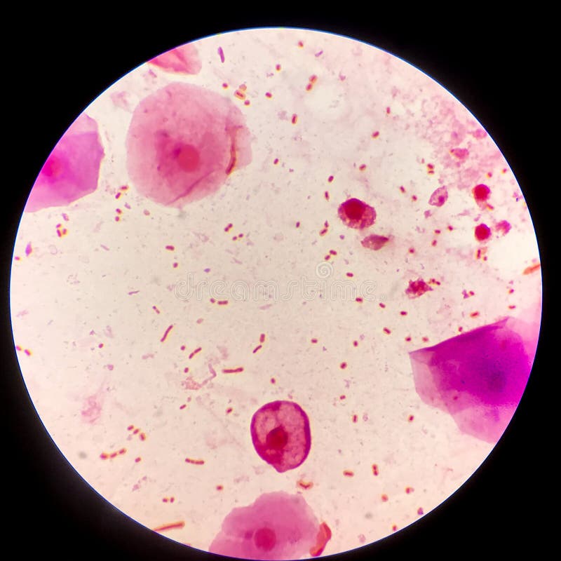 14+ Red cells bacteria Free Stock Photos - StockFreeImages