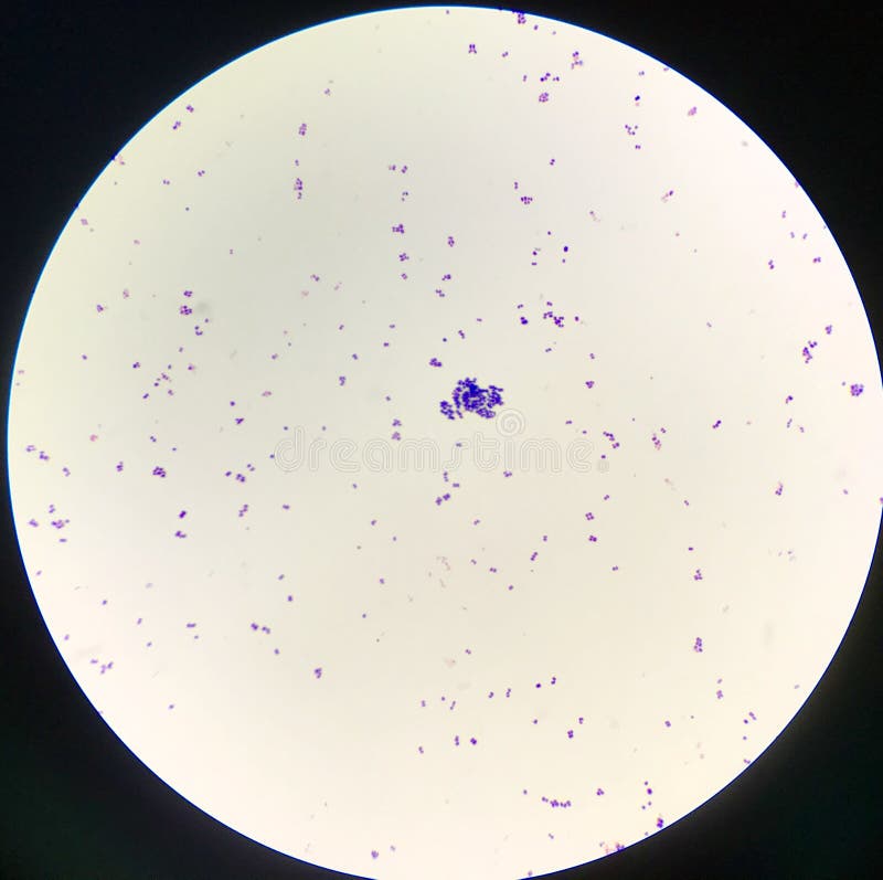 Cocci Bacteria In Urine
