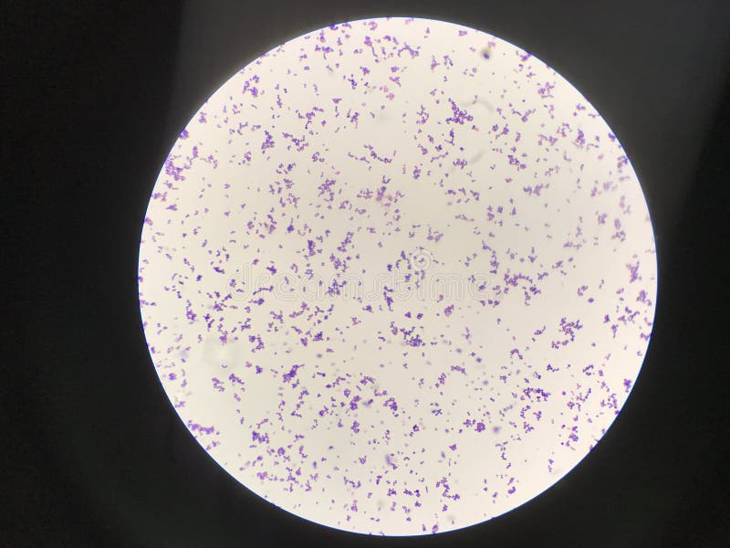 Bacillus Cereus Simple Stain