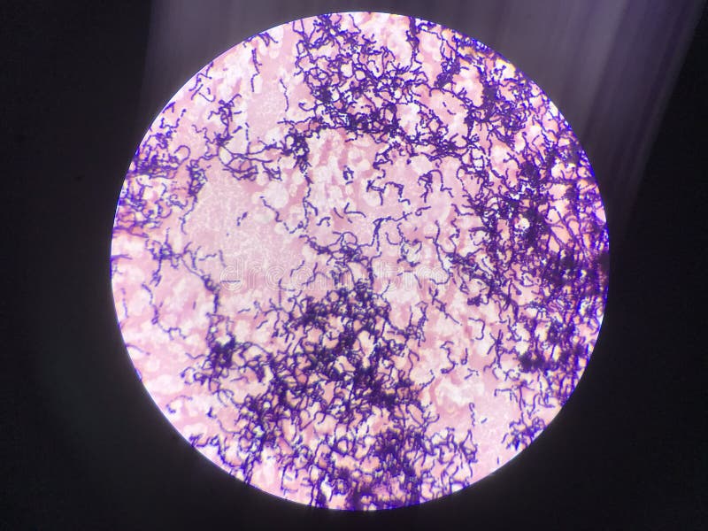 Bacteria Cell in Gram Stain Testing. Stock Photo - Image of healthy ...