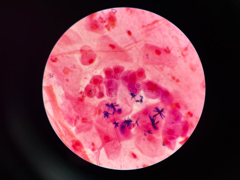 Sputum Culture Gram Stain