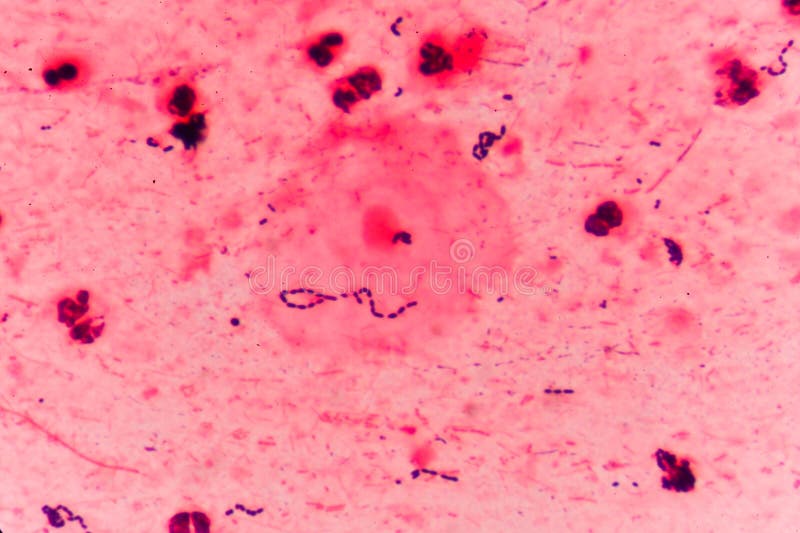 Bacteria Cells Gram Positive Cocci in Chain . Stock Photo - Image of ...