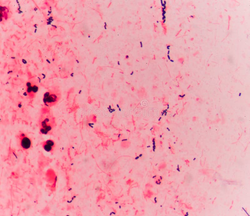 Bacteria Cells Gram Positive Cocci in Chain . Stock Image - Image of ...