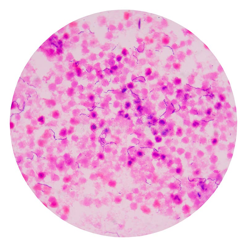 Bacteria cells on Gram stock image. Image of acid, gram - 90274587