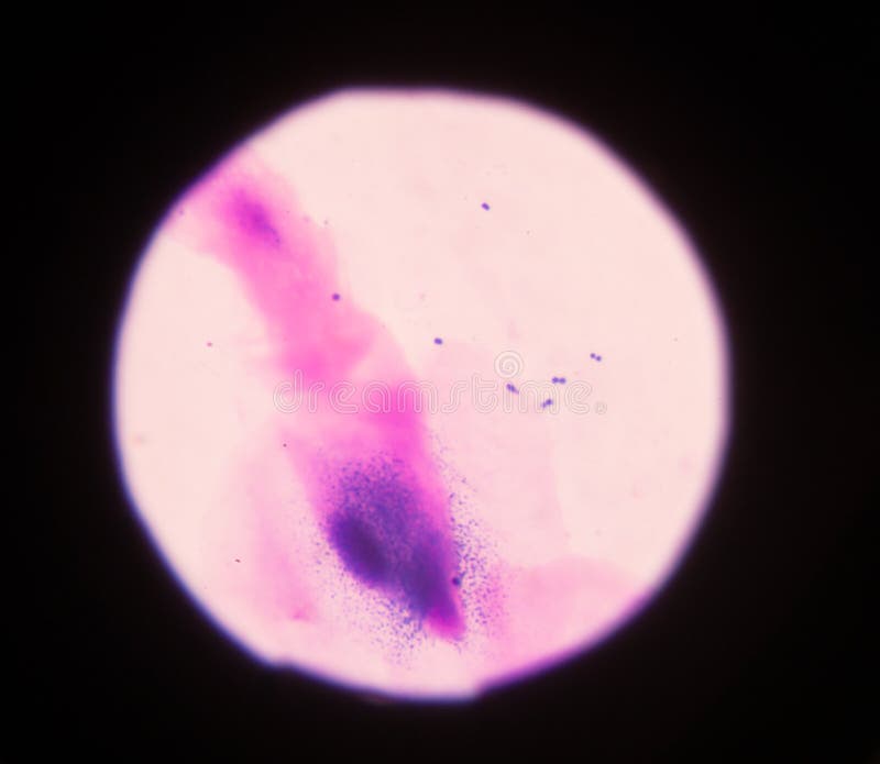 Bacteria Cells on Gram Stain Stock Image - Image of blue, negative ...