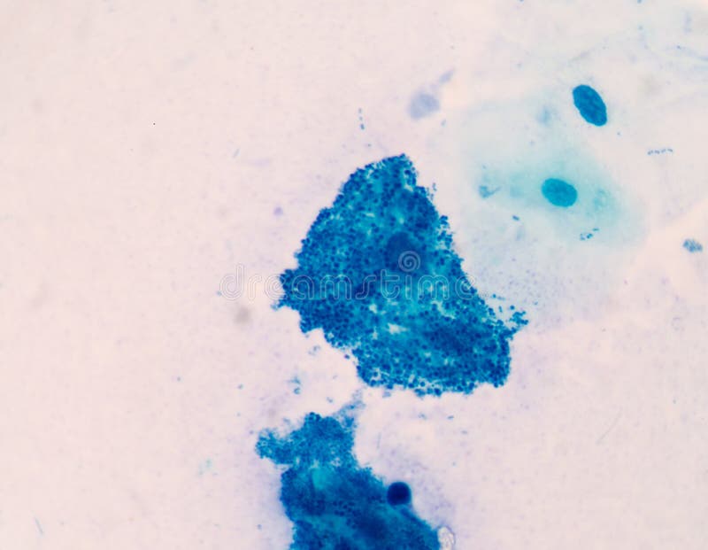 Bacteria cells science stock photo. Image of infect, microbiology ...