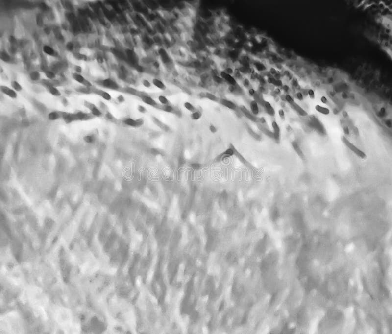 Bacteria or Cells Under the Microscope. Multiplication of Bacteria or ...