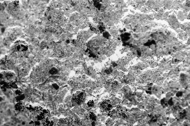 Bacteria or Cells Under a Microscope. Multiplication of Bacteria or ...