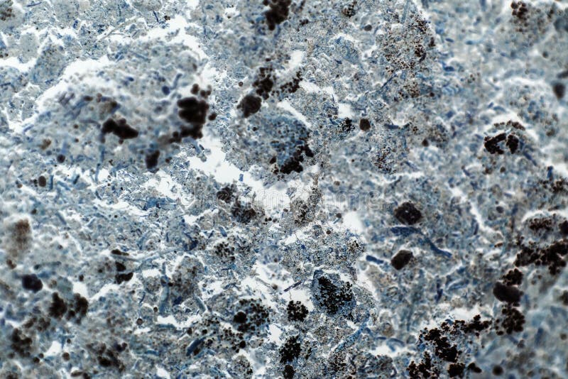 Bacteria or Cells Under a Microscope. Multiplication of Bacteria or ...