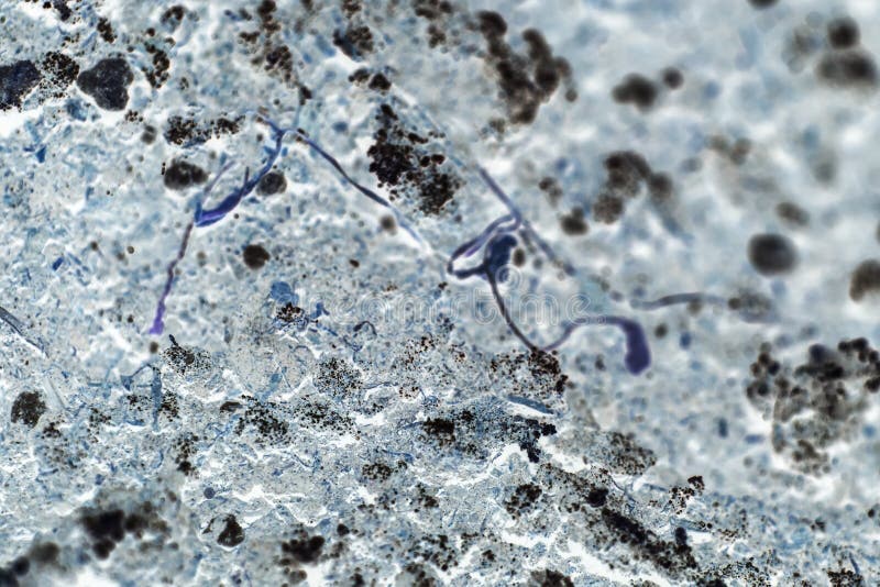 Bacteria or Cells Under a Microscope. Multiplication of Bacteria or ...