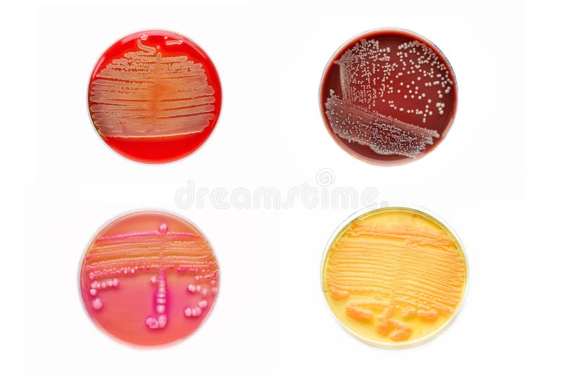 232 Streptococcus Colonies Stock Photos - Free & Royalty-Free Stock ...