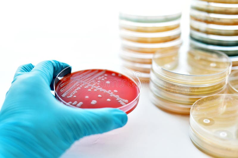 Yellow Bacteria Colonies on a Petri Plate Stock Photo - Image of ...