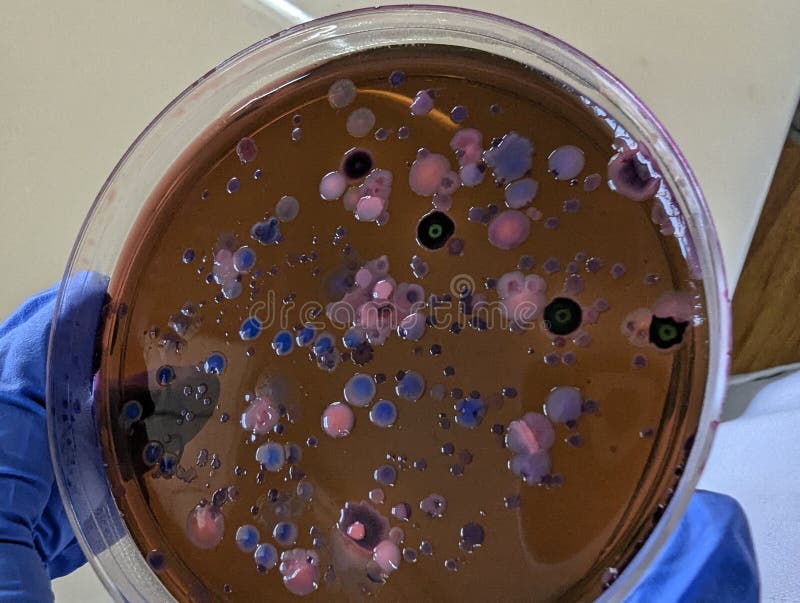 Bacterial Growth on Eosin Methylene Blue Agar Stock Image - Image of ...
