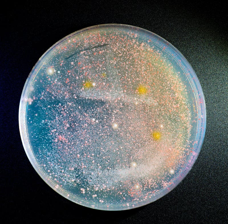 How To Measure Bacterial Colonies In A Petri Dish at Gabriella Raiwala blog