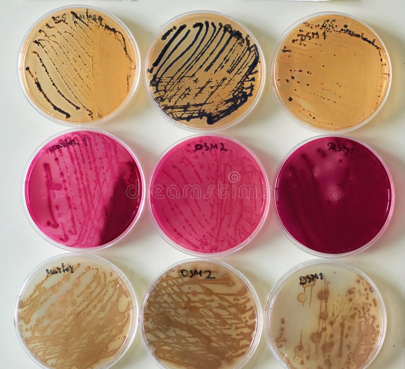Microbiology Agar Plates Characteristics And Different Shaped Colony
