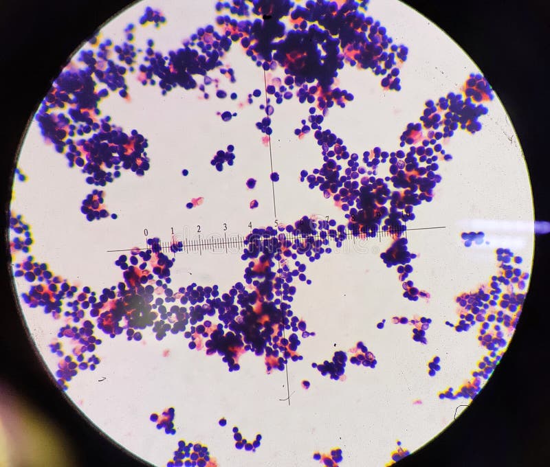 Bacteria Combination Under Microscope, Very Unique Stock Photo - Image ...