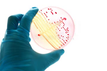 Bacterial Colonies Culture Macconkey Agar Media Stock Photos - Free ...