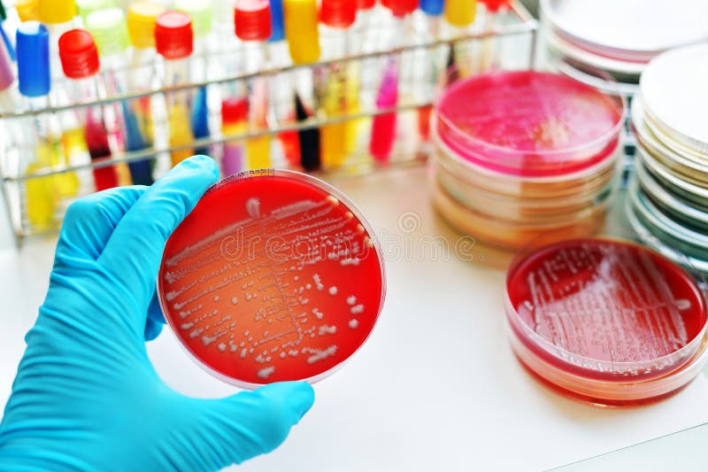 Bacteria culture stock image. Image of antibiotic, agar - 70355423