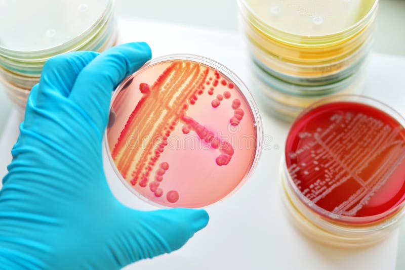Bacteria culture stock image. Image of culture, acinetobacter - 70356029