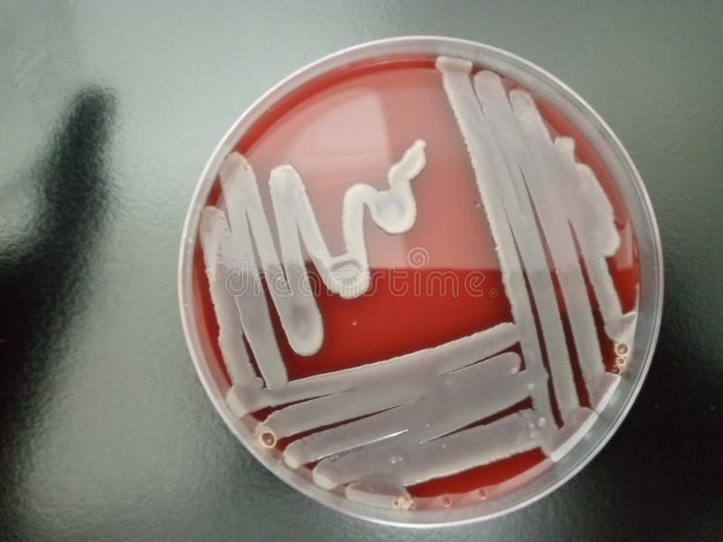 Bacteria on a Culture Medium Stock Photo - Image of glass, clothing ...