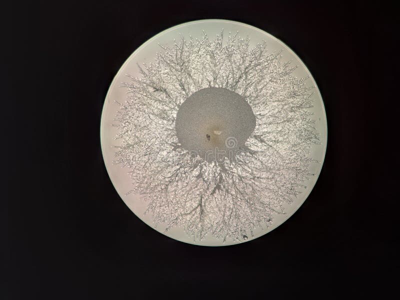 Fungi and Bacteria Under the Microscope Stock Image - Image of ...