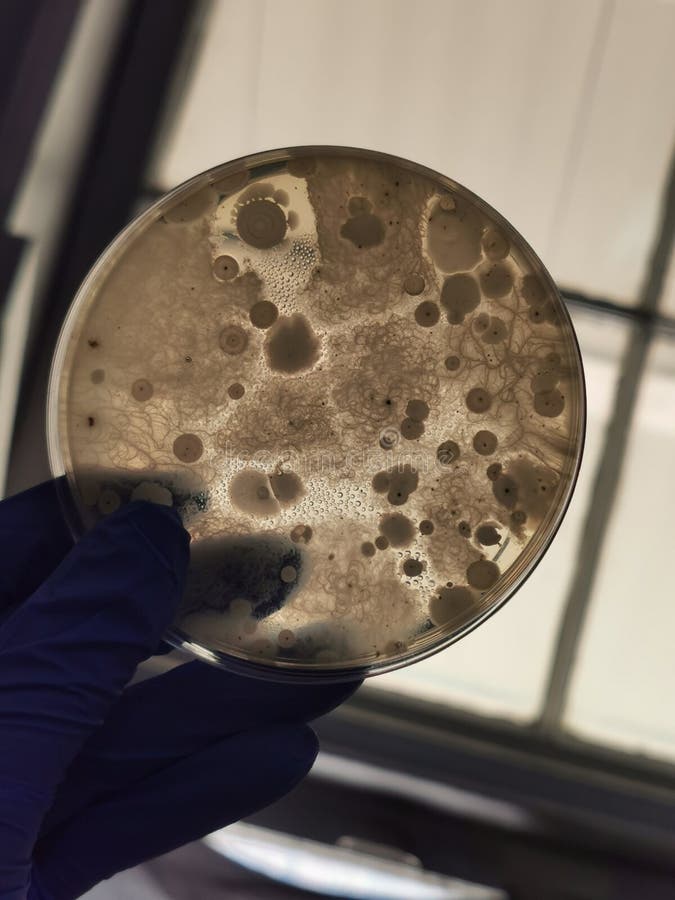 Bacteria Growing on an Agar Plate Stock Photo - Image of circle ...