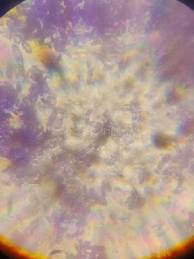 Bacteria Growing on Decaying Beet Stock Image - Image of microscope ...