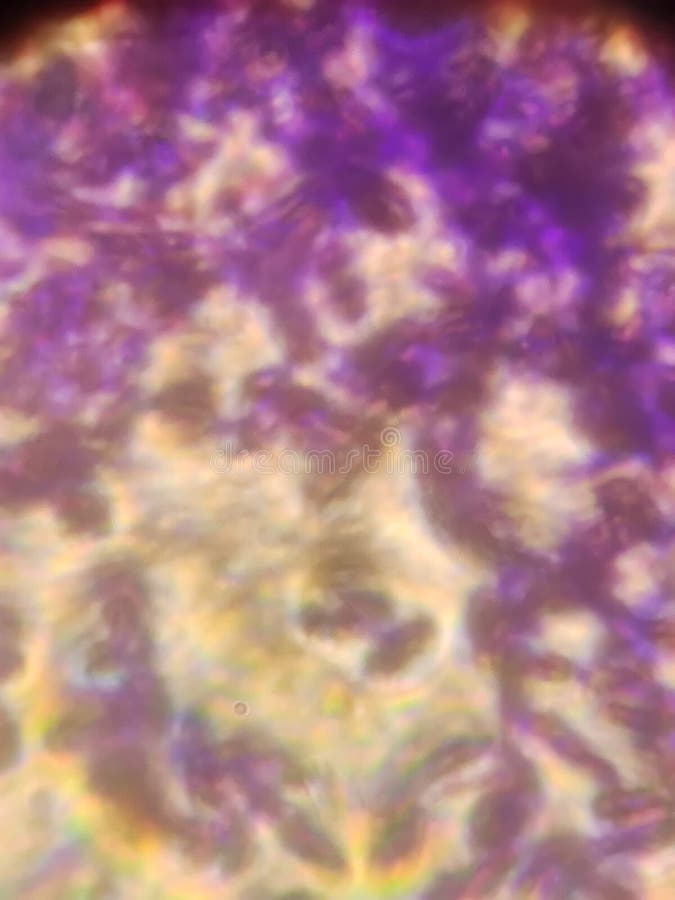 Bacteria Growing on Decaying Beet Stock Photo - Image of science, beta ...