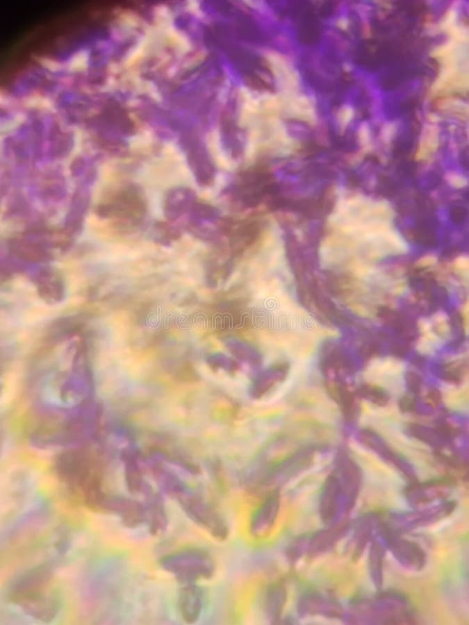 Bacteria Growing on Decaying Beet Stock Image - Image of bacteria ...