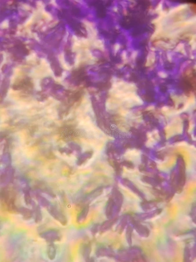 Bacteria Growing on Decaying Beet Stock Photo - Image of bacteria ...