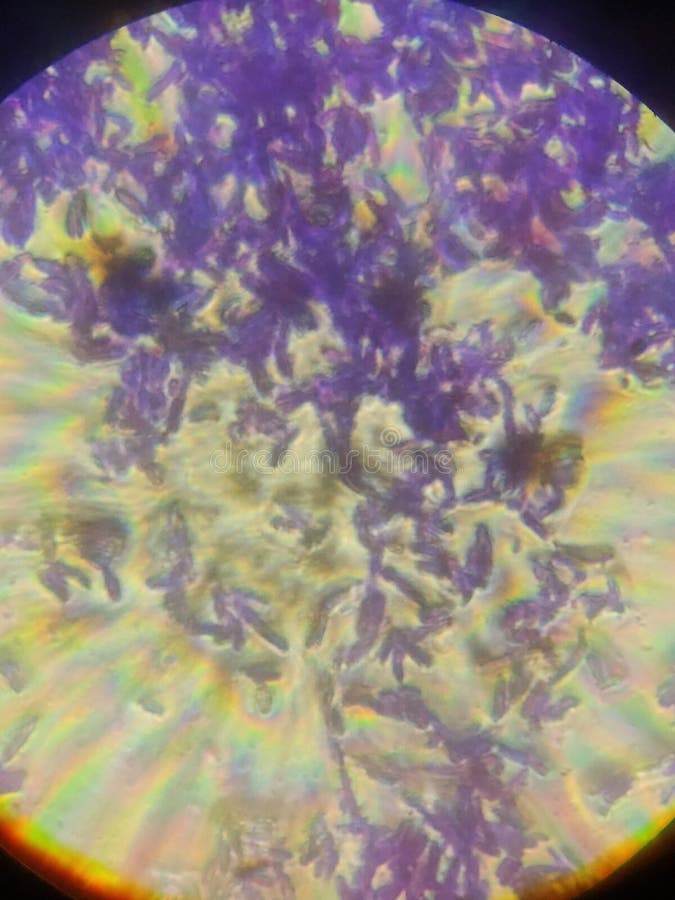 Bacteria Growing on an Agar Plate. Stock Image - Image of education ...