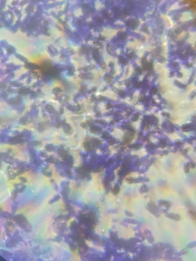 Bacteria Growing on Decaying Beet Stock Image - Image of biology, beta ...