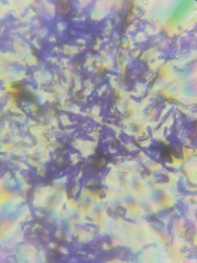 Bacteria Growing on Decaying Beet Stock Image - Image of vulgaris ...